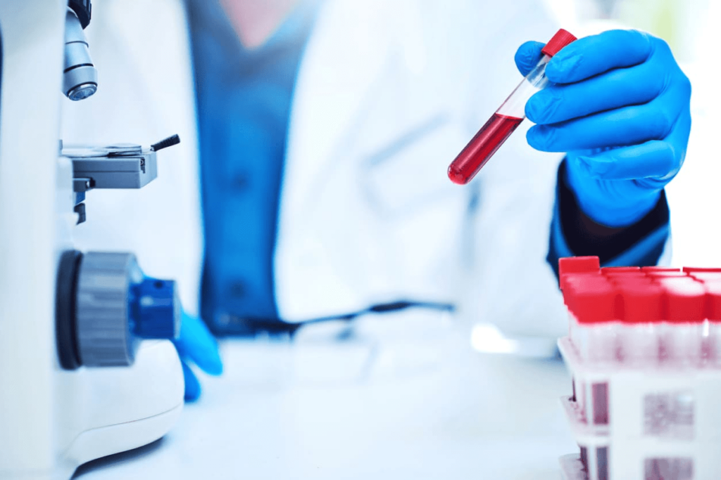 Biomarkers & Lab Testing for Tailoring Hormone Dosage - Nexel Medical